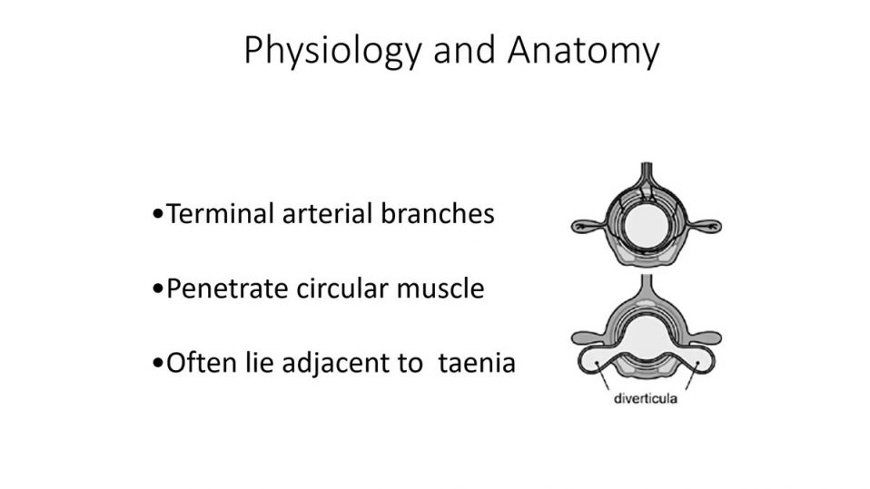 Diverticular disease explained - Red Trouser Day (RTD)